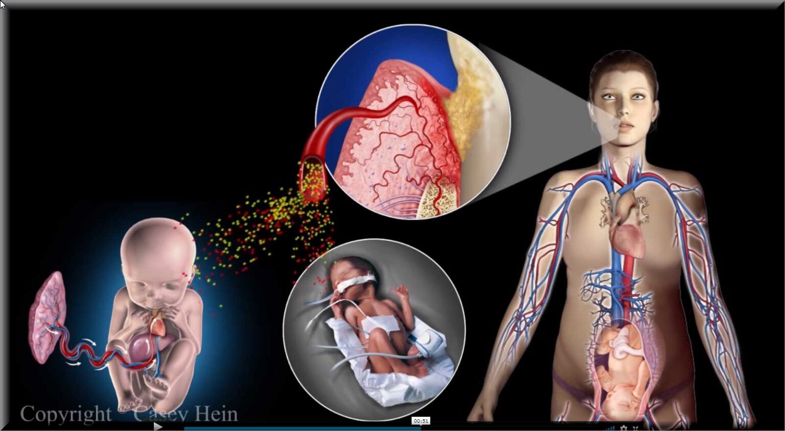 Animated Mini-Messages to Educate Patients about Periodontal-Systemic ...